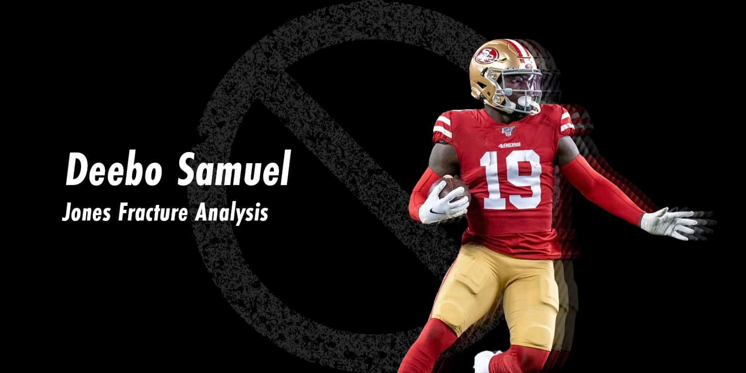 The Undroppables - Deebo Samuel | Jones Fracture Analysis